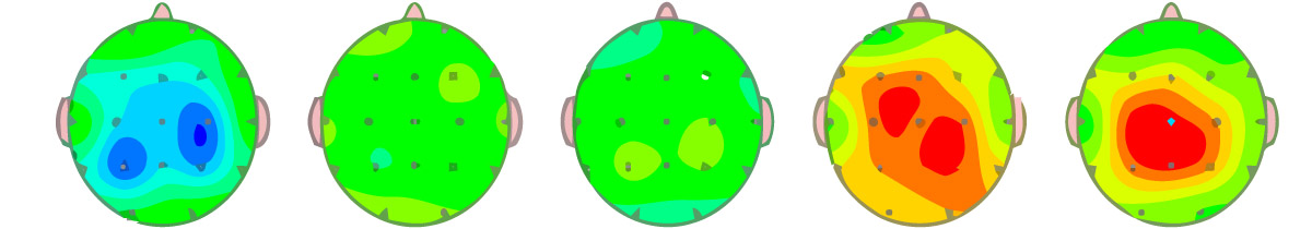 QEEG Brain Mapping - Brain Work Centers